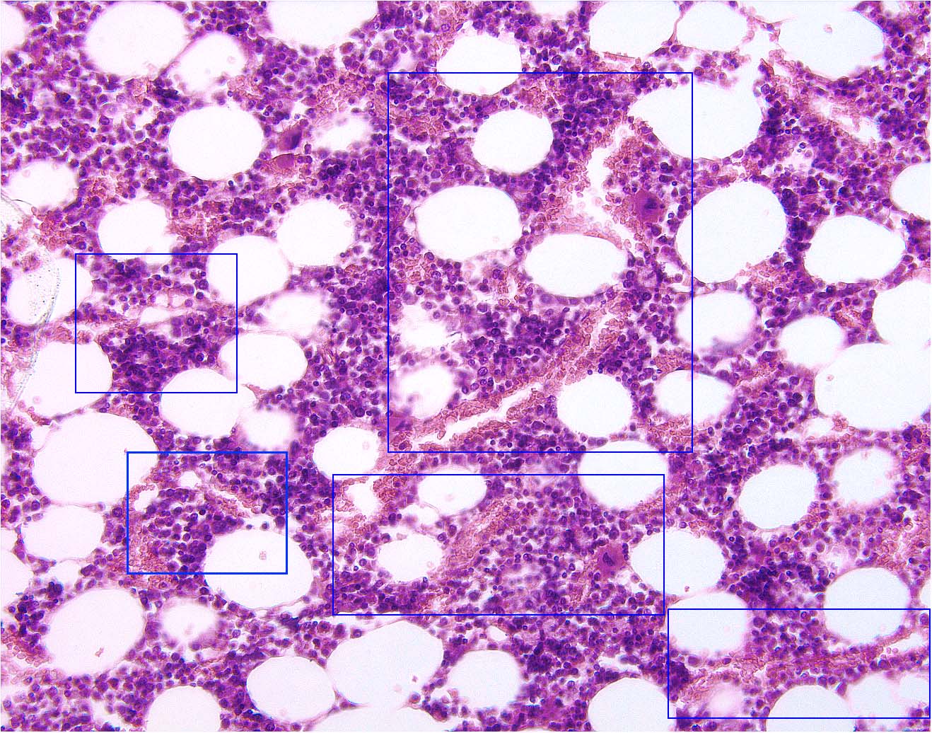 Bone Marrow with Capillaries at 200X Magnification