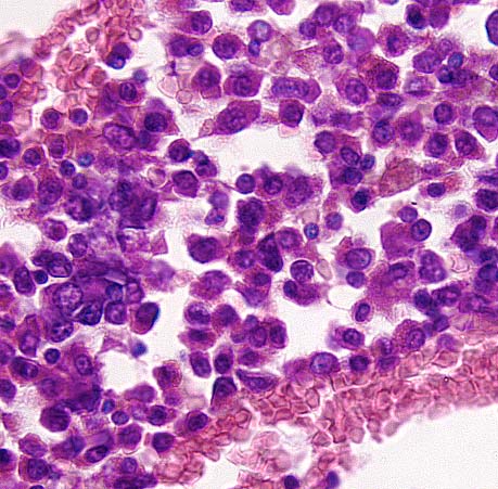 Bone Marrow with Capillaries at 400X Magnification