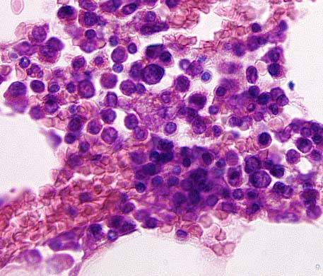 Bone Marrow with Capillaries at 400X Magnification