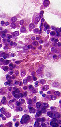 Bone Marrow with Capillaries at 400X Magnification