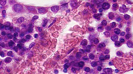 Bone Marrow with Capillaries and Endothelial Cells at 400X Magnification