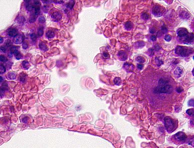 Bone Marrow with Capillaries and Endothelial Cells at 400X Magnification
