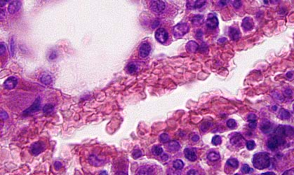Bone Marrow with Capillaries and Endothelial Cells at 400X Magnification