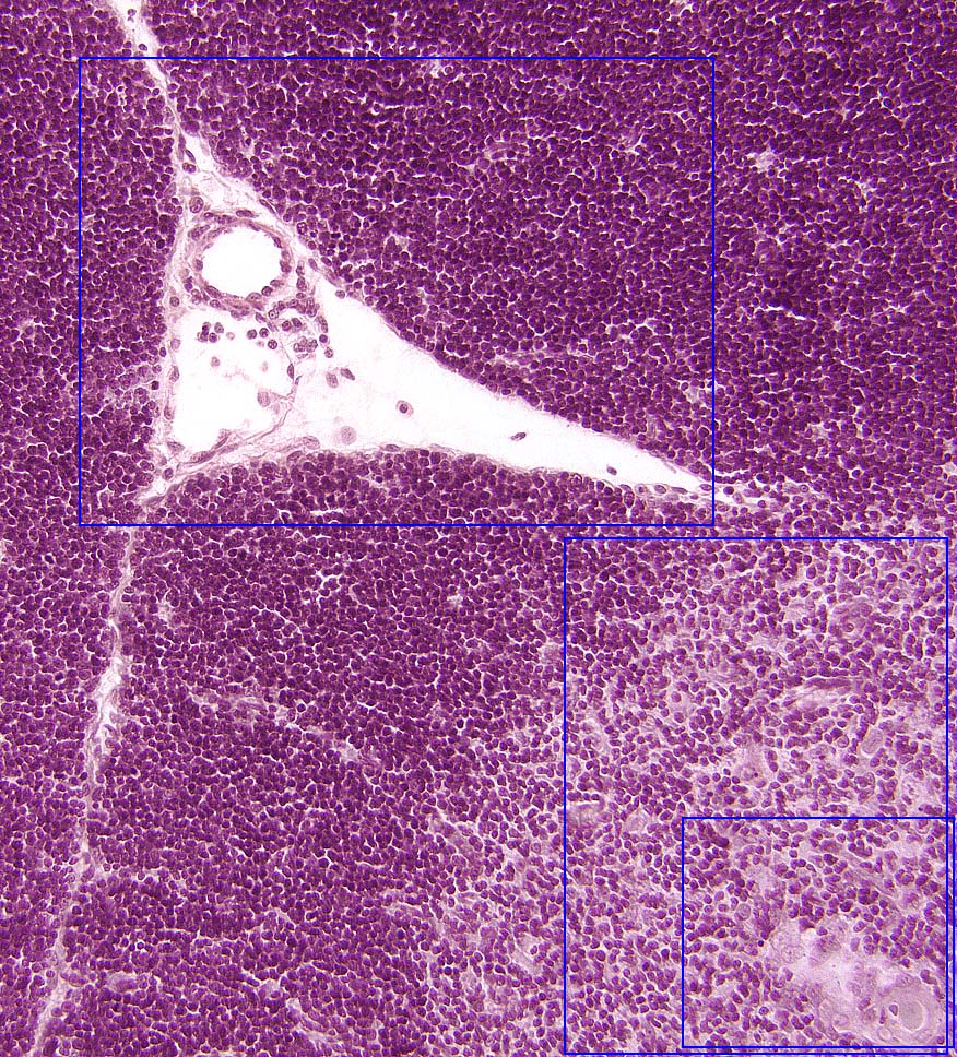 200X Magnification of Thymus Vascular Tissue