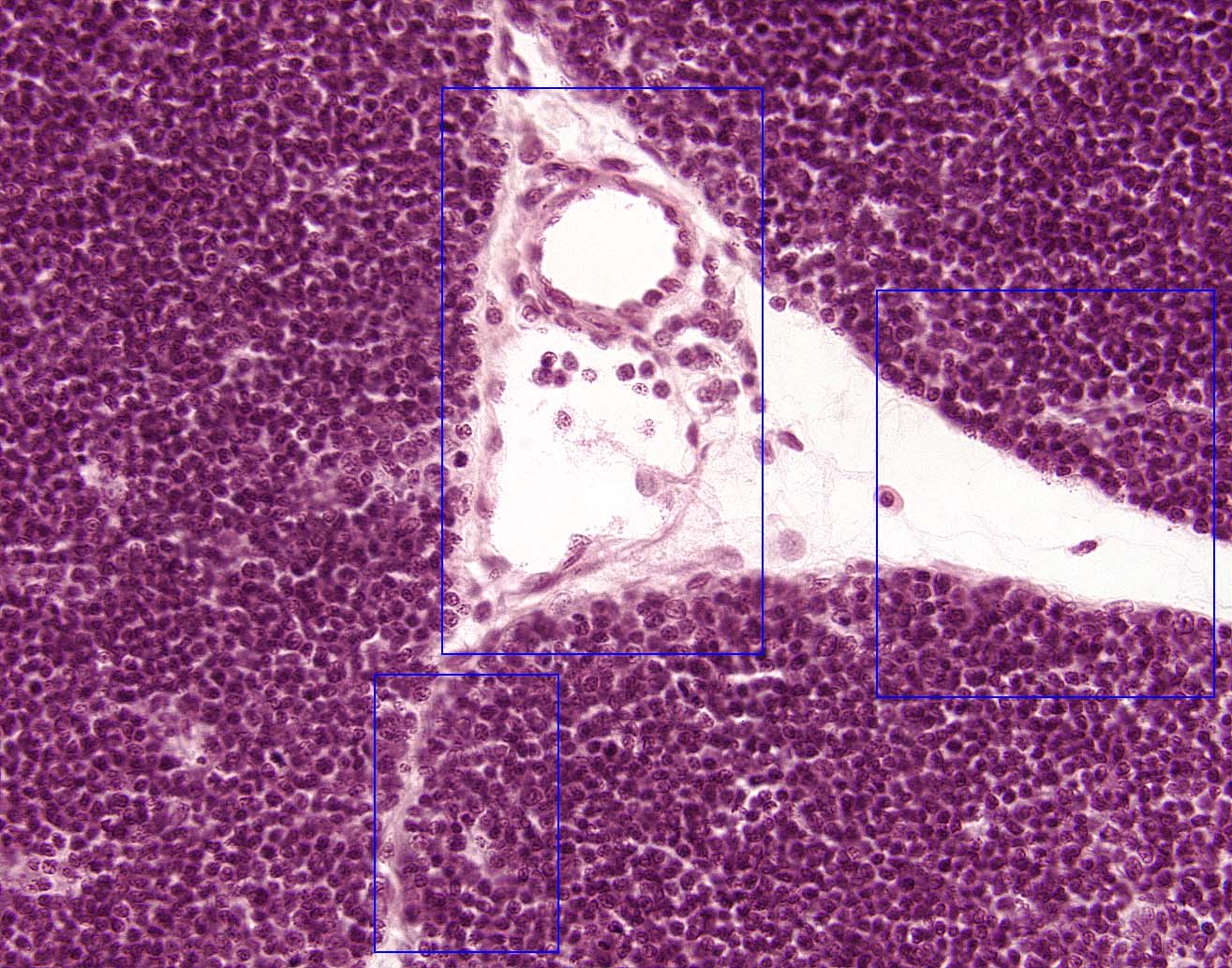 Vascular Tissue of Thymus at 400X Magnification