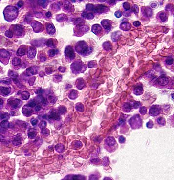 Bone Marrow with Capillaries at 400X Magnification