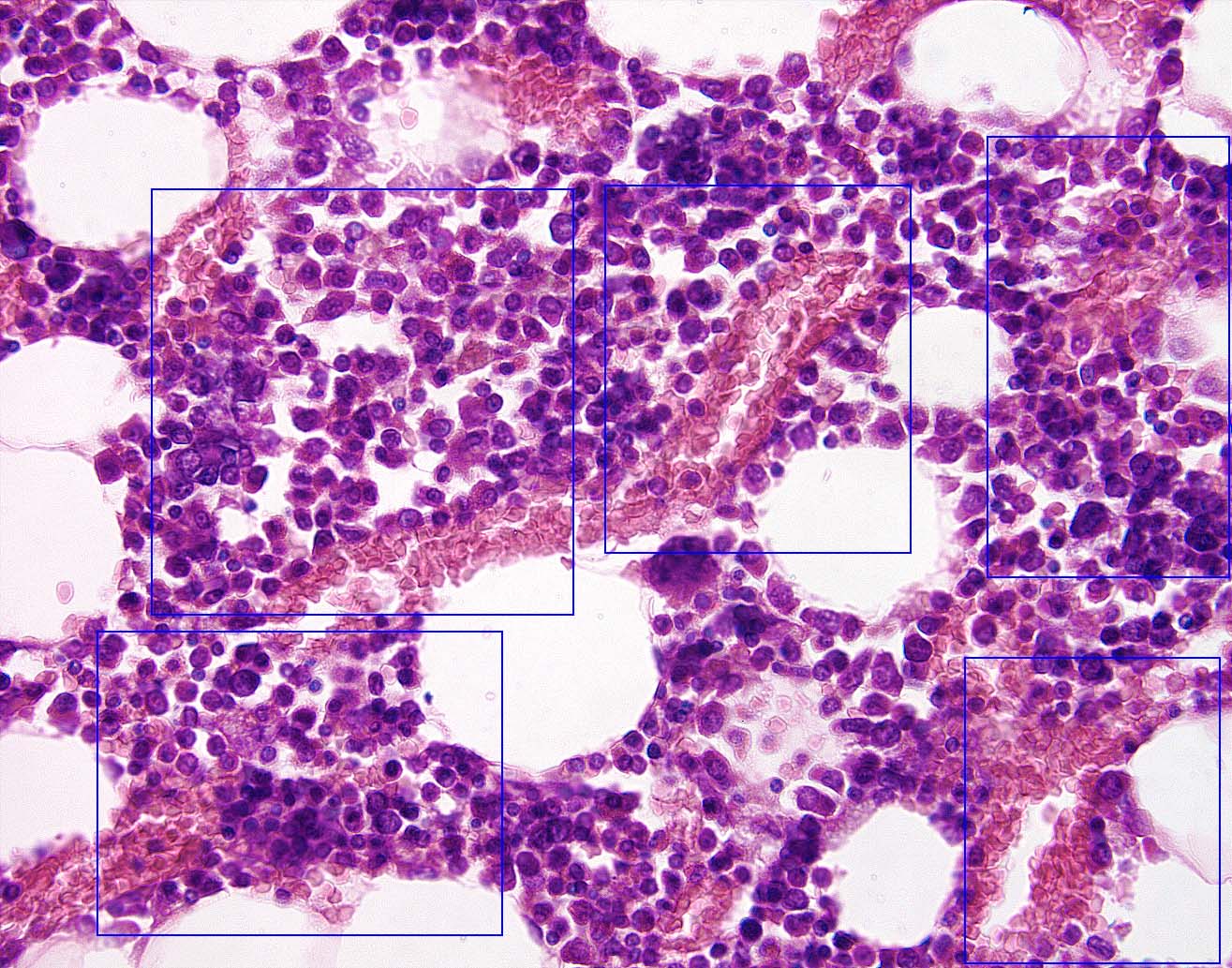Bone Marrow with Capillaries at 400X Magnification