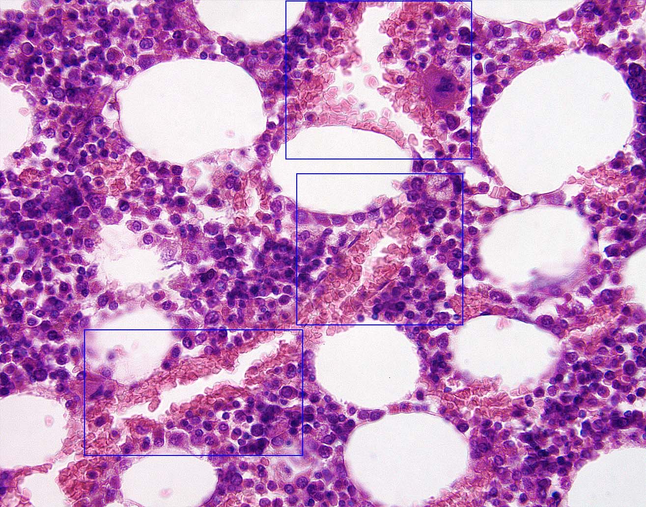 Bone Marrow Cells Histology