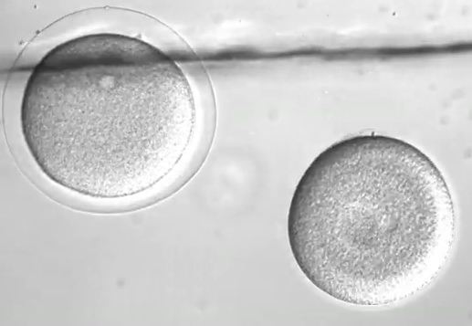 Film Festival of Sea Urchin Fertilization