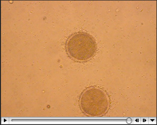 Film Festival of Sea Urchin Fertilization