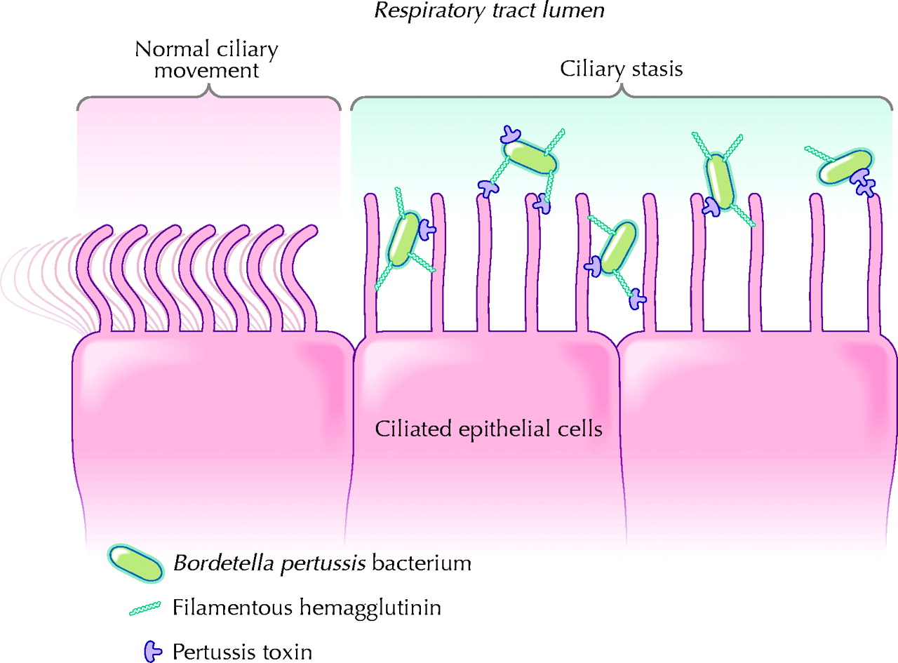 pertussis bacteria